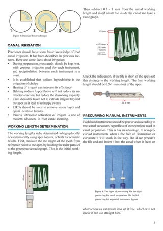 Root Canal Preparation Basics | PDF