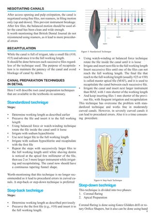 Root Canal Preparation Basics | PDF