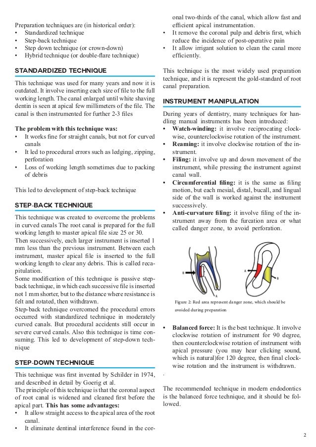 Root Canal Preparation Basics