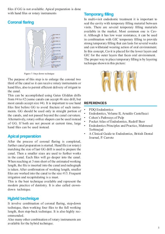 Root Canal Preparation Basics
