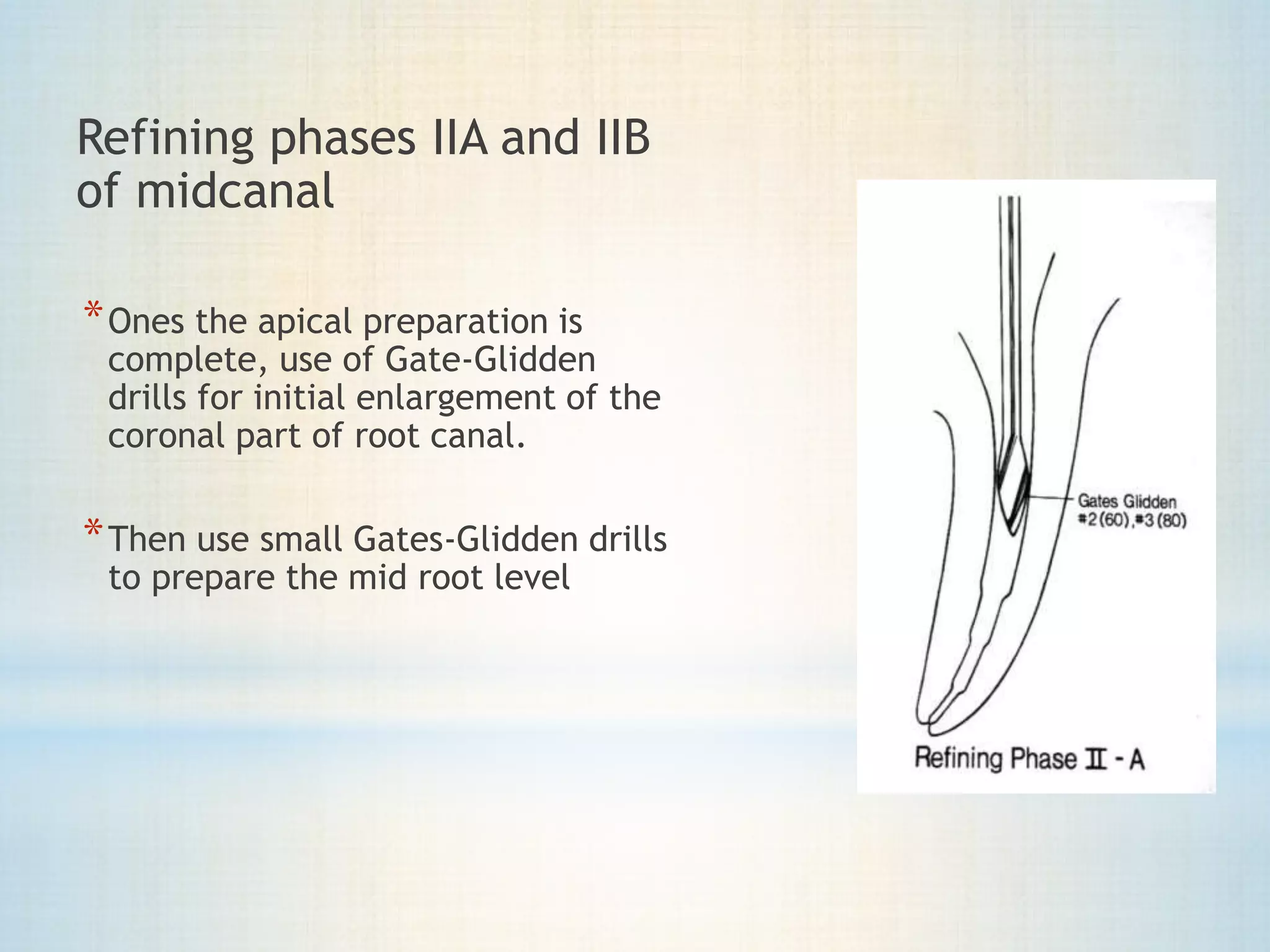 Root canal preparation techniques _ endodontic treatment | PPTX