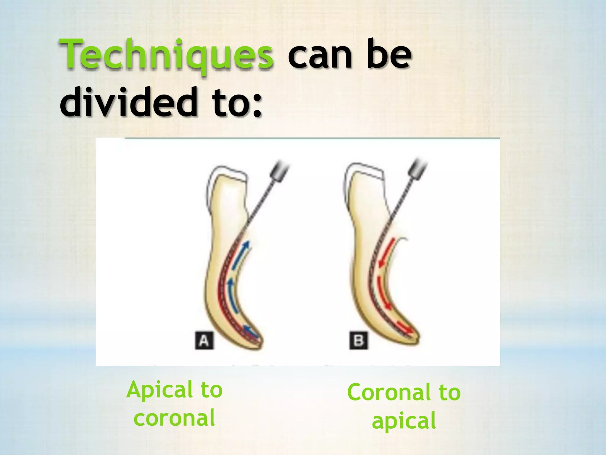 Root canal preparation techniques _ endodontic treatment | PPTX