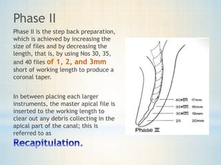 Root canal preparation techniques _ endodontic treatment | PPTX