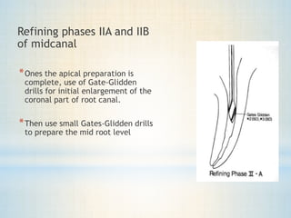 Root canal preparation techniques _ endodontic treatment | PPTX
