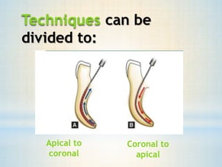 Root canal preparation techniques _ endodontic treatment | PPTX