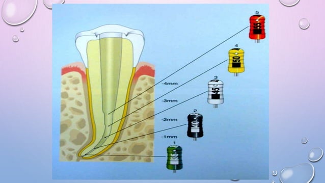 Root canal preparation techniques | PPTX | Dental Health | Diseases and ...