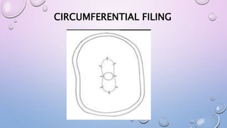 Root canal preparation techniques | PPTX