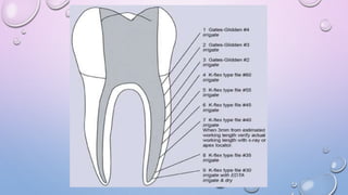 Root canal preparation techniques | PPTX