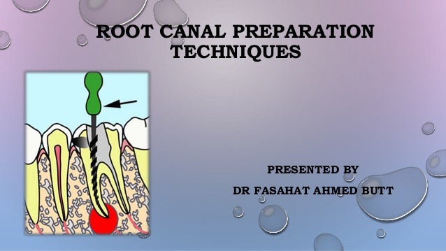 Root Canal Preparation Techniques