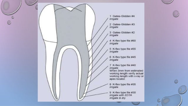 Root Canal Preparation Techniques