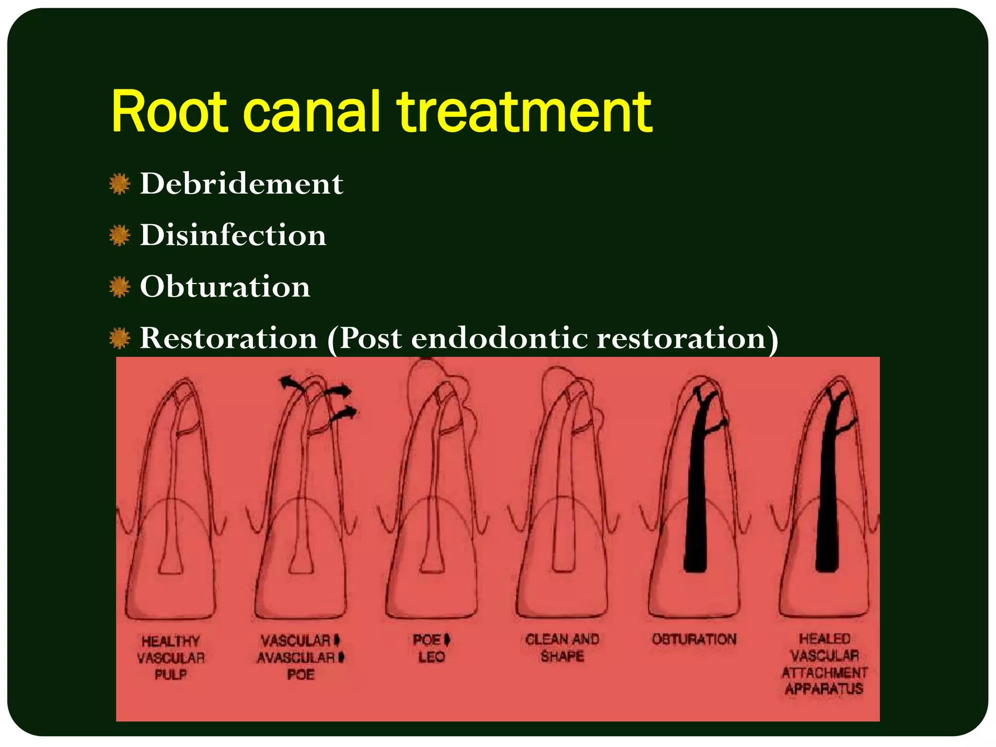 ROOT CANAL PROCEDURE.pdf