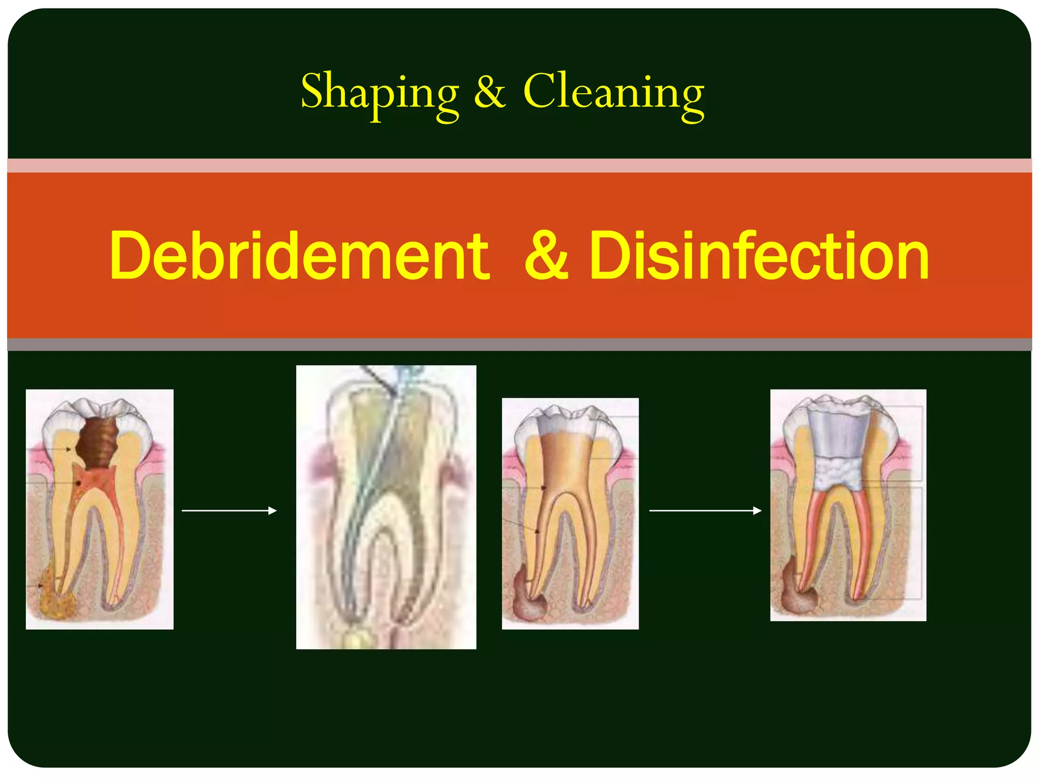 Root Canal Procedurepdf 0207