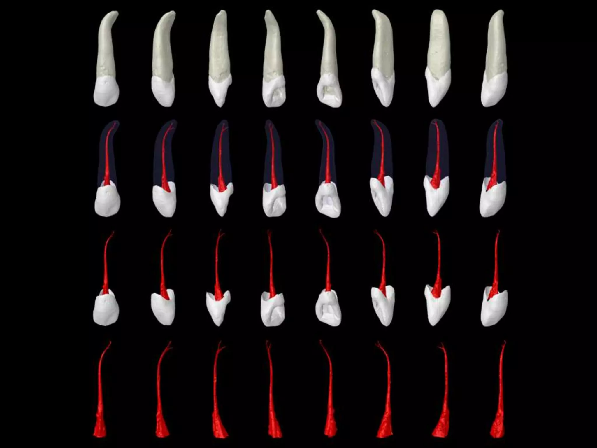 Root canals morphology and configurations - maxillary teeth | PPTX