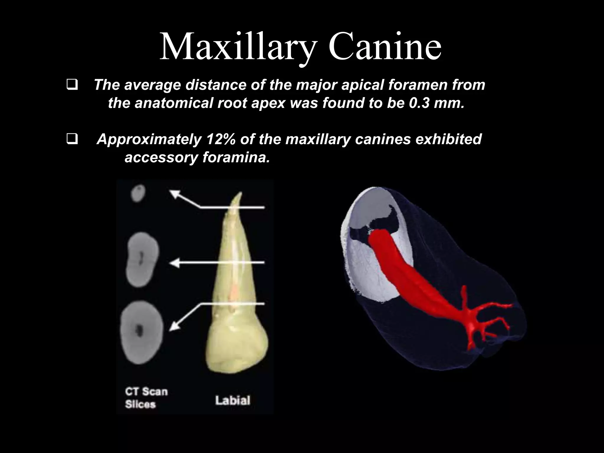 Root canals morphology and configurations - maxillary teeth | PPTX
