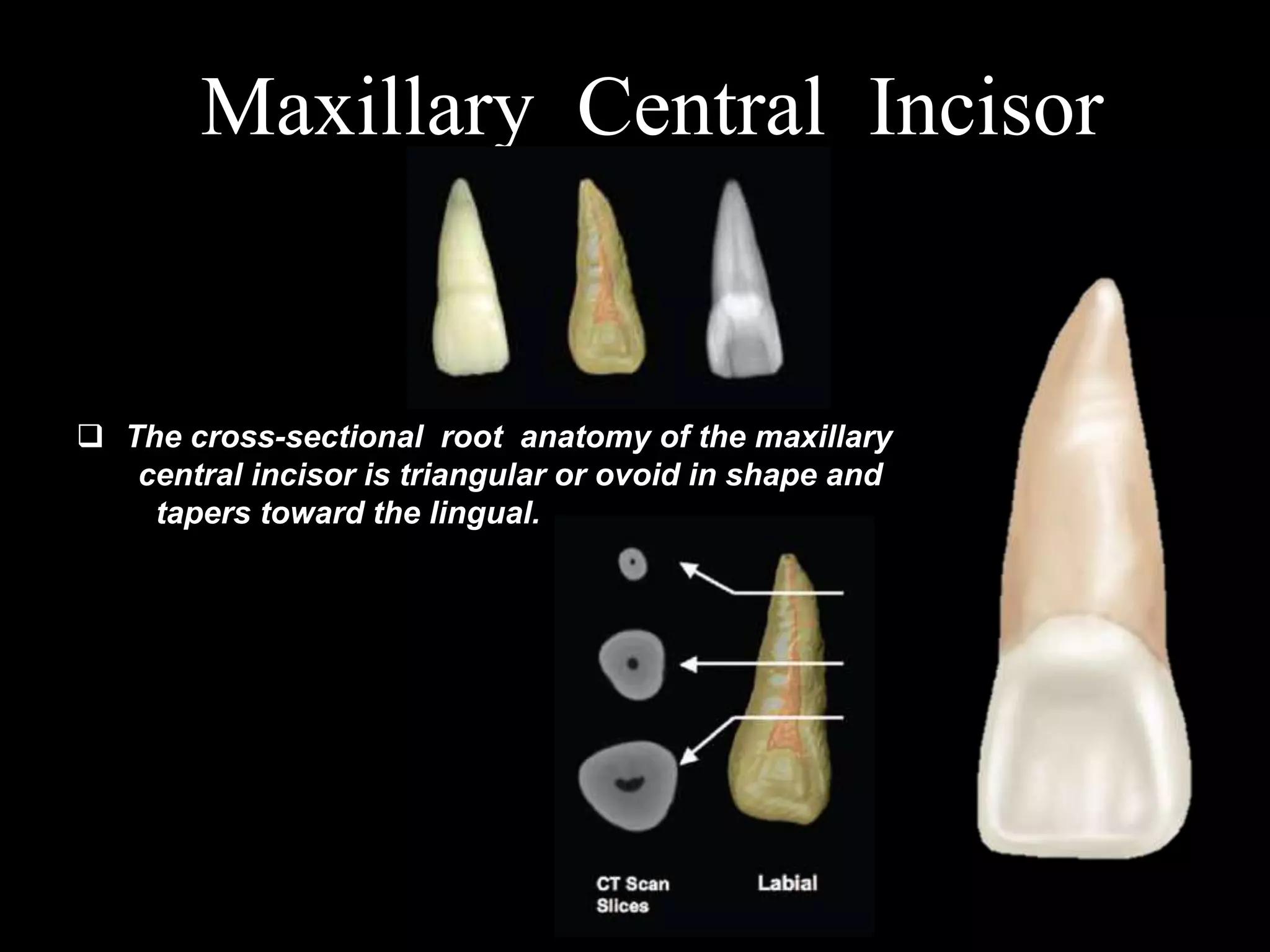 Root canals morphology and configurations - maxillary teeth | PPTX