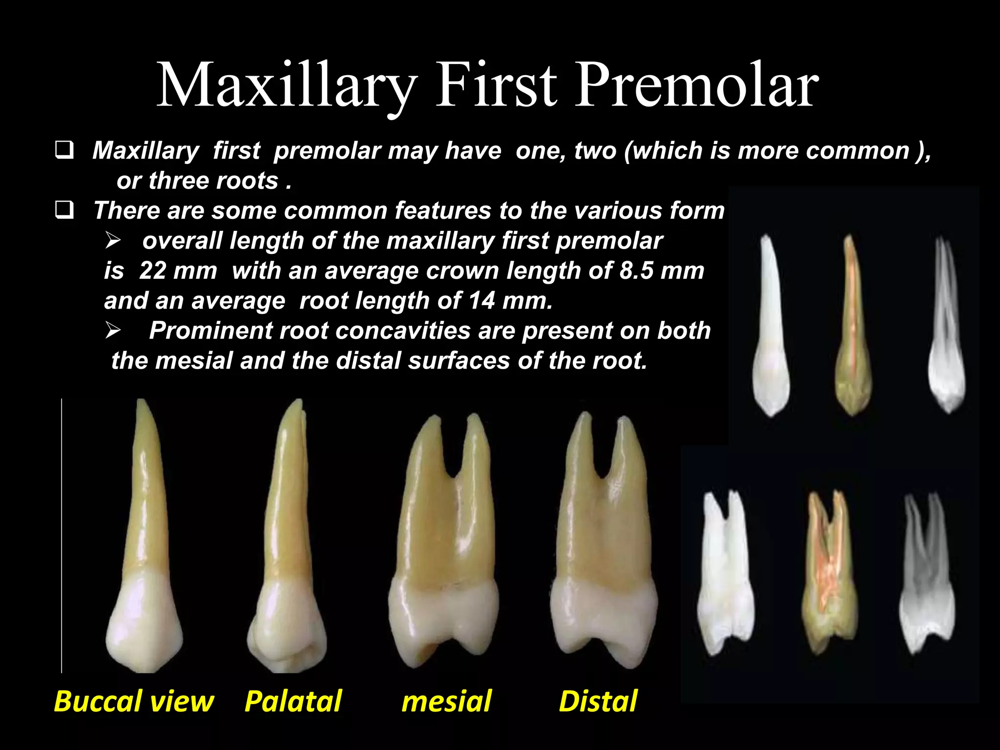 Root canals morphology and configurations - maxillary teeth | PPTX