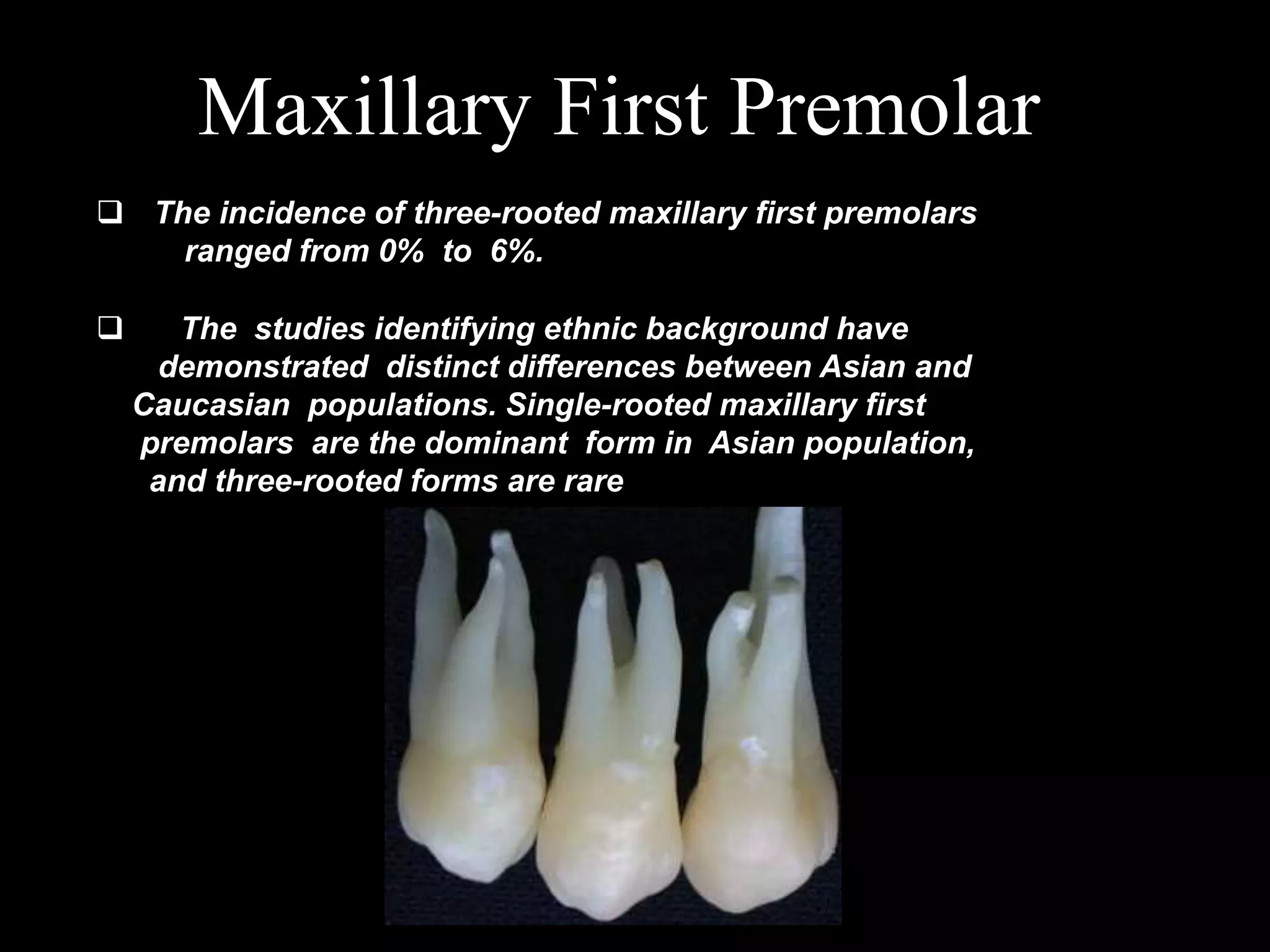Root canals morphology and configurations - maxillary teeth | PPTX