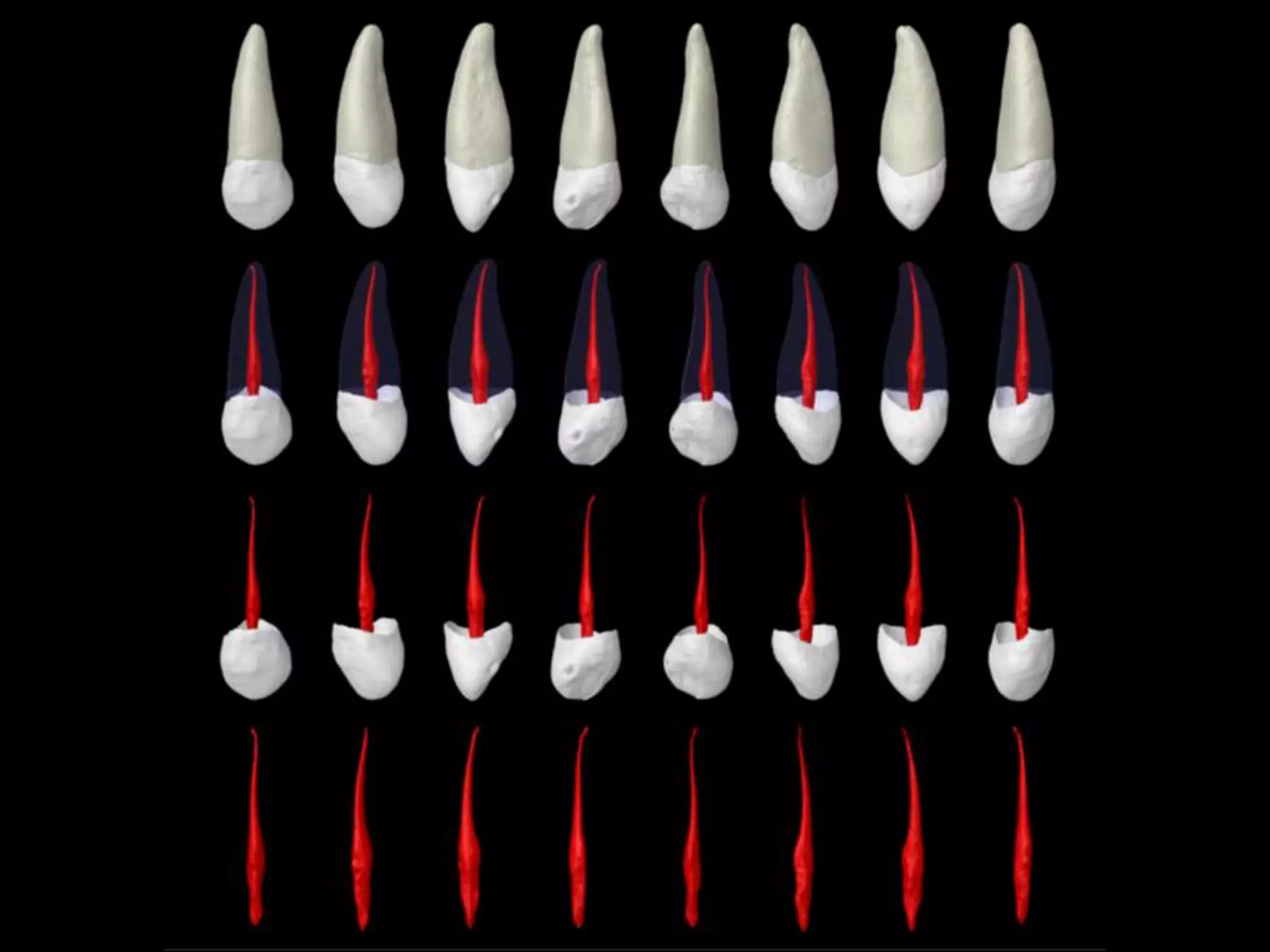 Root canals morphology and configurations - maxillary teeth | PPTX