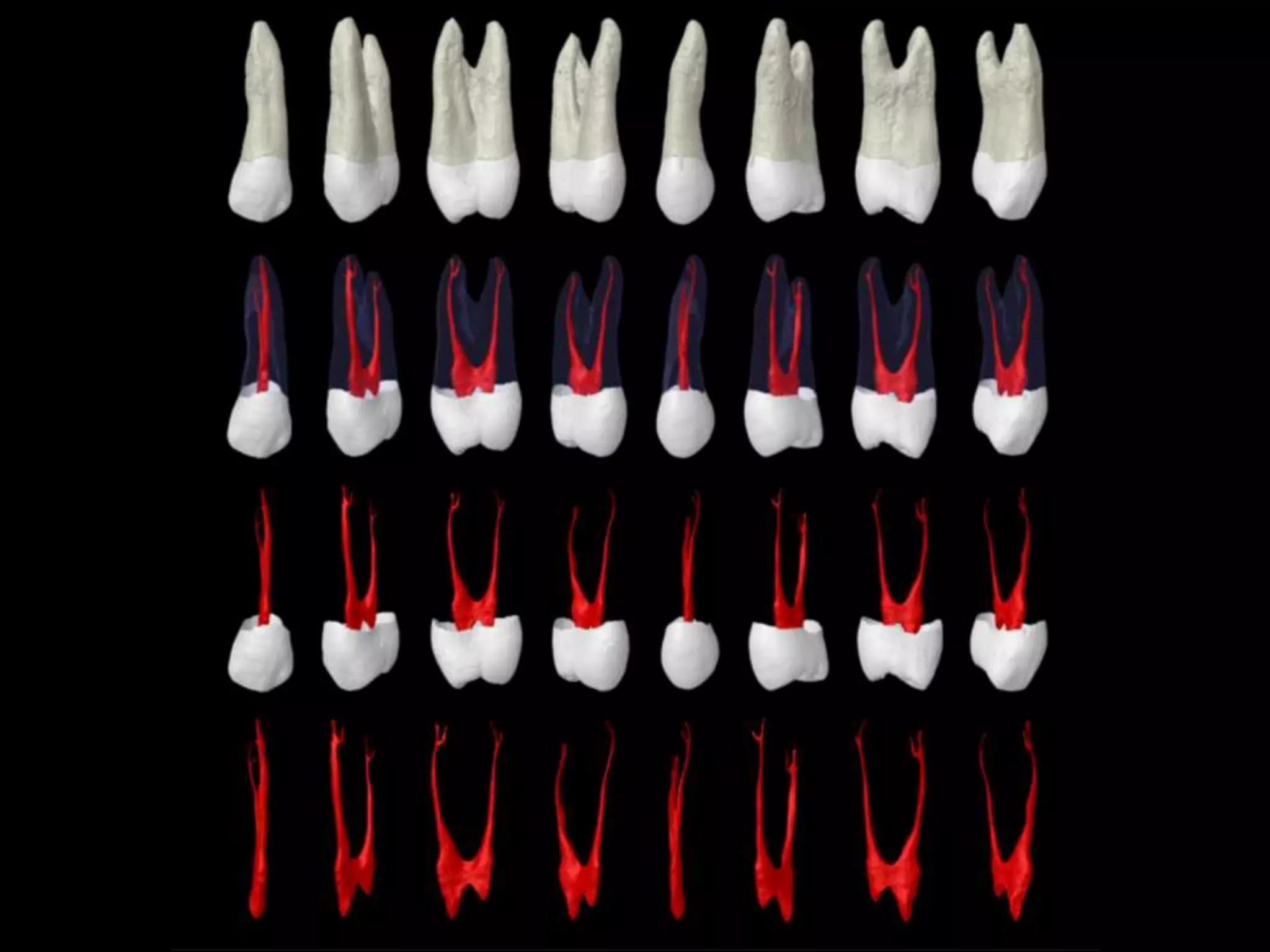 Root canals morphology and configurations - maxillary teeth | PPTX ...
