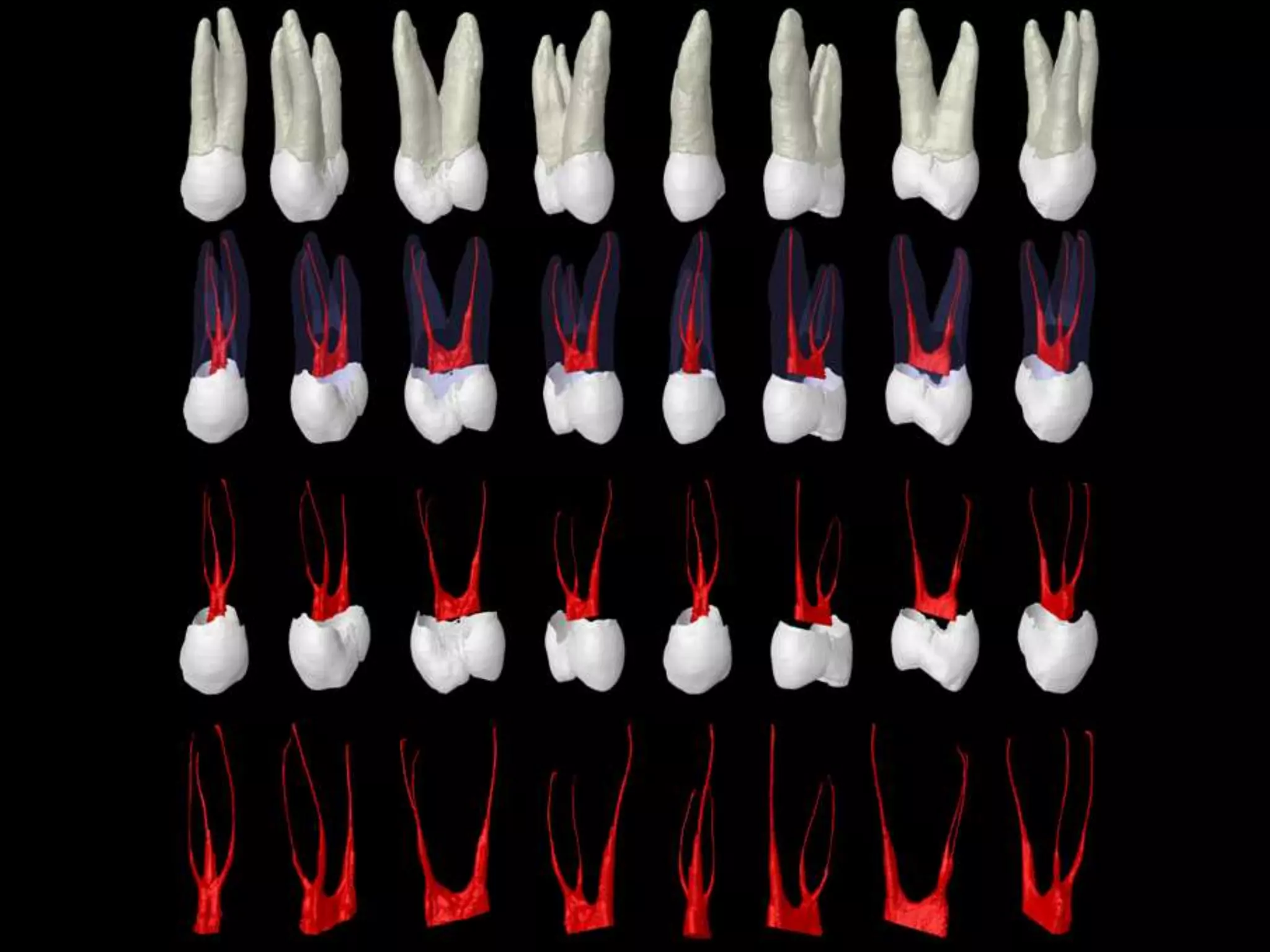 Root canals morphology and configurations - maxillary teeth | PPTX