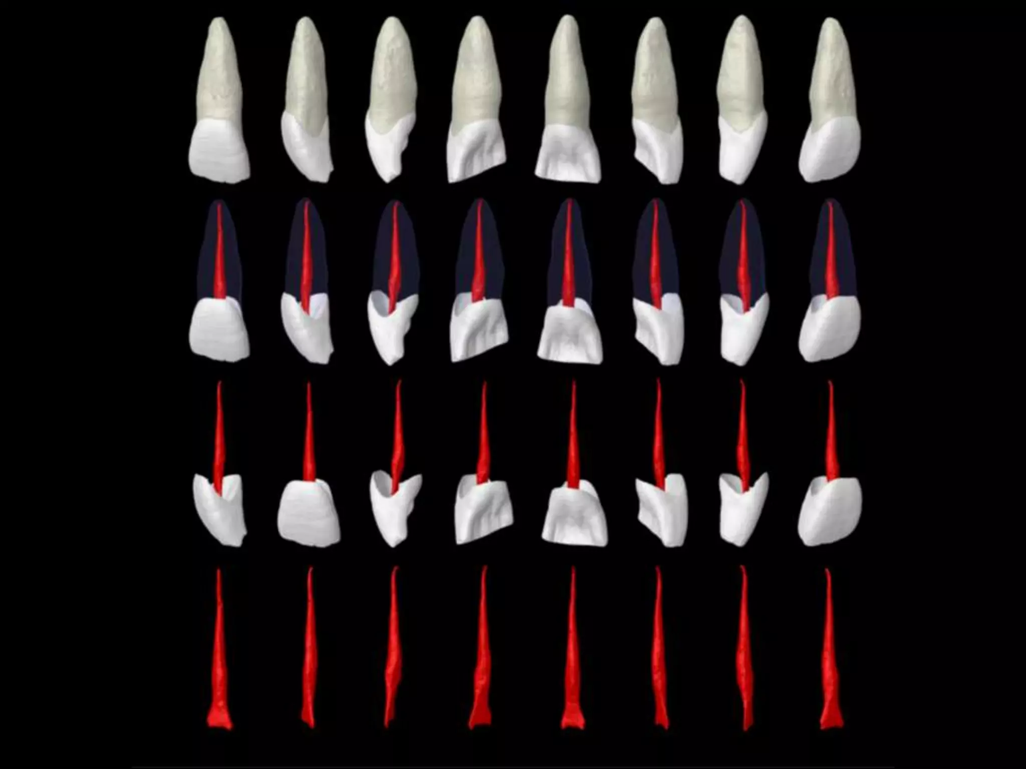 Root canals morphology and configurations - maxillary teeth | PPTX