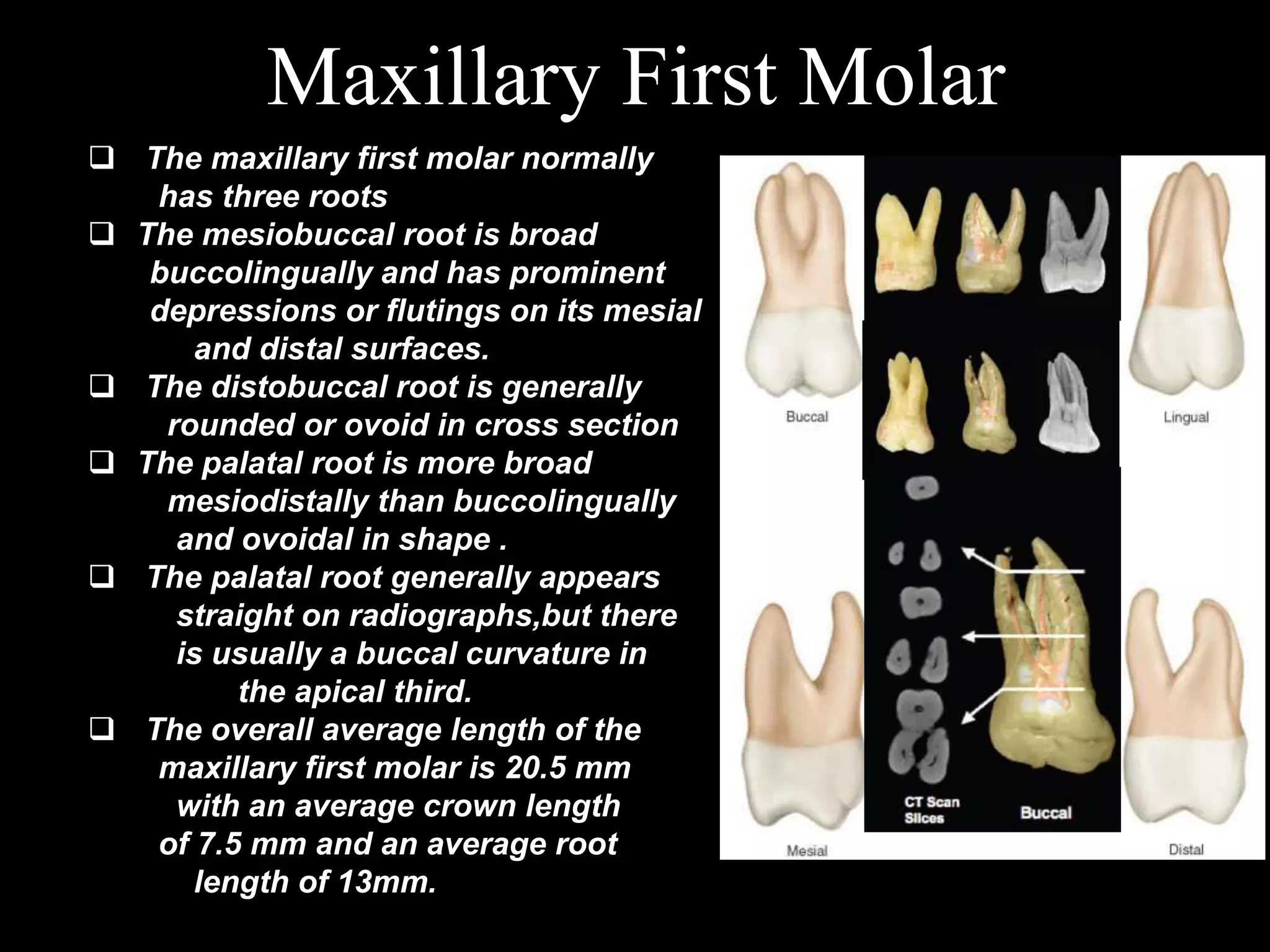Root canals morphology and configurations - maxillary teeth | PPTX