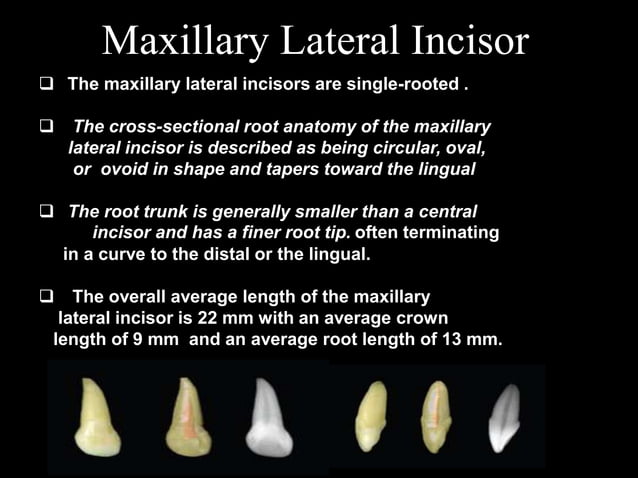 Root canals morphology and configurations - maxillary teeth | PPTX ...