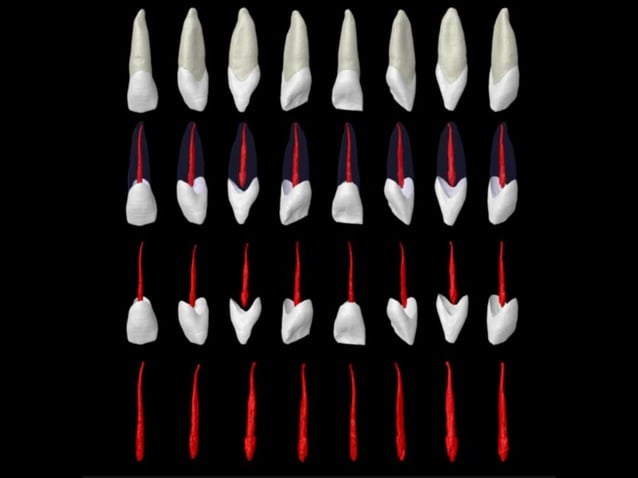 Root canals morphology and configurations - maxillary teeth | PPTX ...