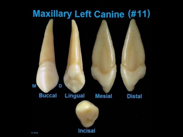 Root canals morphology and configurations - maxillary teeth | PPTX ...