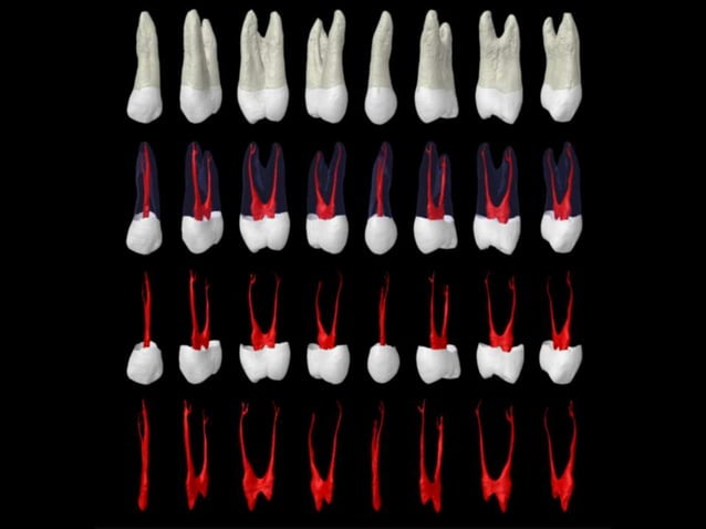 Root canals morphology and configurations - maxillary teeth | PPTX ...