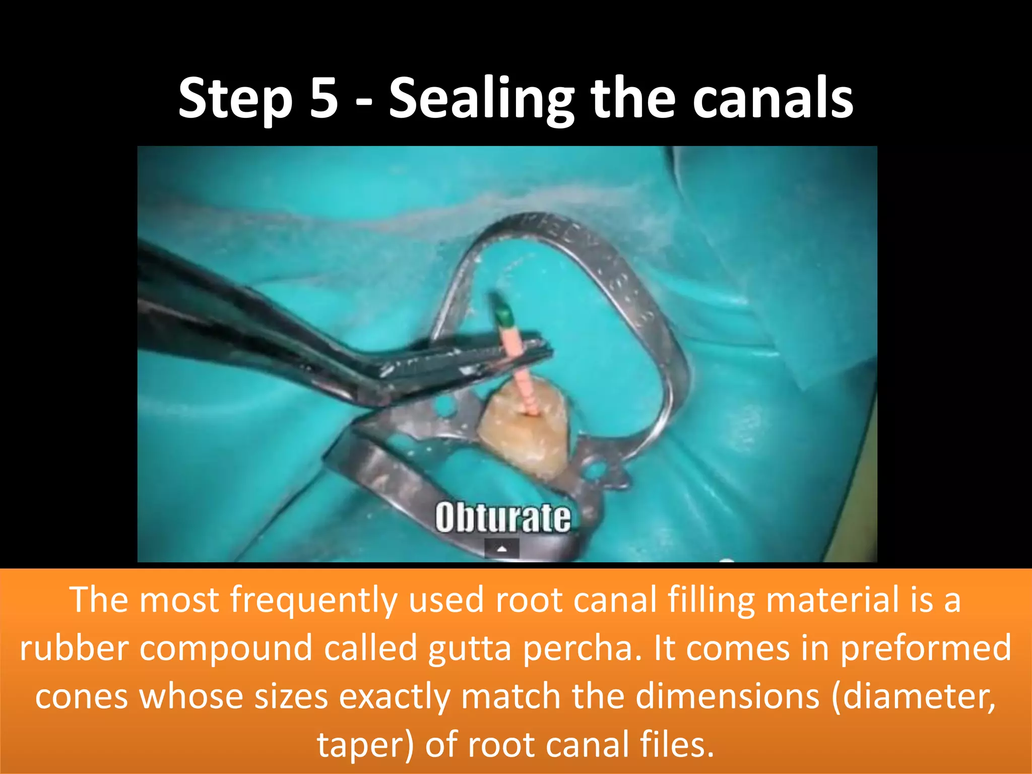 Root canal treatment | PDF
