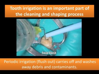 Root canal treatment | PDF