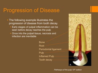 Root Canal Treatment | PDF