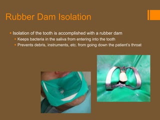 Root Canal Treatment | PDF