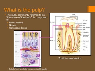 Root Canal Treatment | PDF