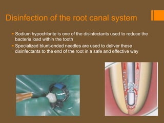 Root Canal Treatment | PDF