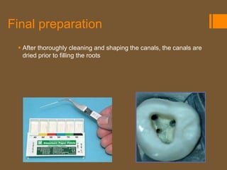 Root Canal Treatment | PDF