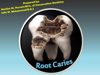 Root Caries | PDF