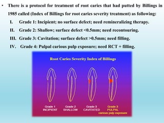 Root Caries | PDF