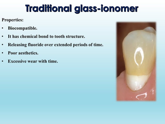 Root Caries | PDF | Dental Health | Diseases and Conditions