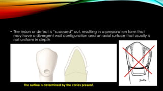 Root caries and class Vclass five tooth.pptx
