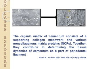 Root conditioning in periodontics | PPTX