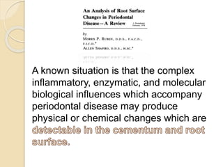 Root conditioning in periodontics | PPTX