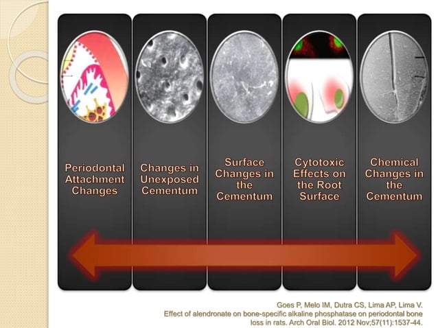 Root conditioning in periodontics | PPTX | Dental Health | Diseases and ...