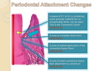 Root conditioning in periodontics | PPTX
