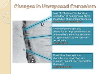 Root conditioning in periodontics | PPTX