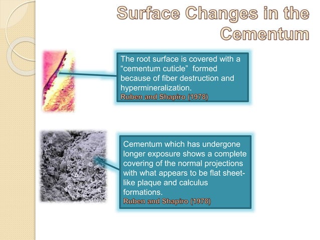 Root conditioning in periodontics | PPTX | Dental Health | Diseases and ...