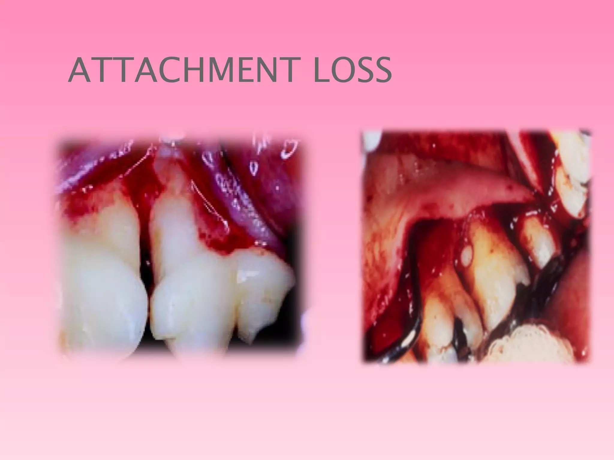 Root conditioning agents | PPT