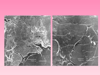 Root conditioning agents | PPT