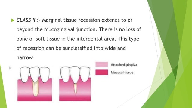 Root coverage procedures periodontics.pptx | Dental Health | Diseases ...